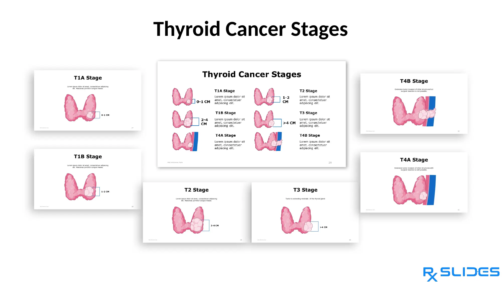 Download Thyroid Cancer PowerPoint Template|RxSlides